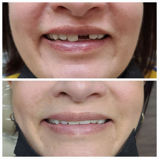 Dentist in San Antonio, TX - Smile Gallery Hardy Oak Family Dentistry ...