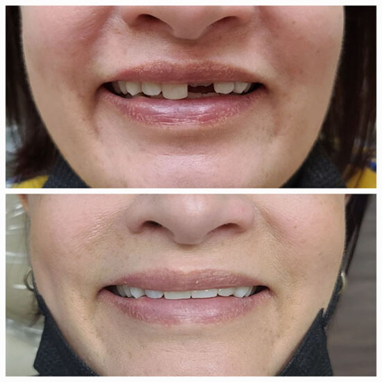 Dentist in San Antonio, TX - Smile Gallery Hardy Oak Family Dentistry ...